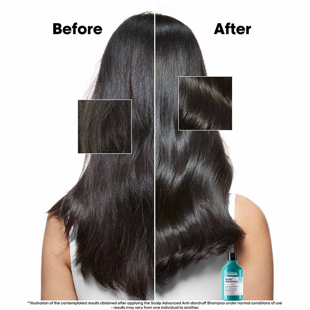 L'Oréal Professionnel Serie Expert Scalp Advanced Anti-Dandruff Dermo ...