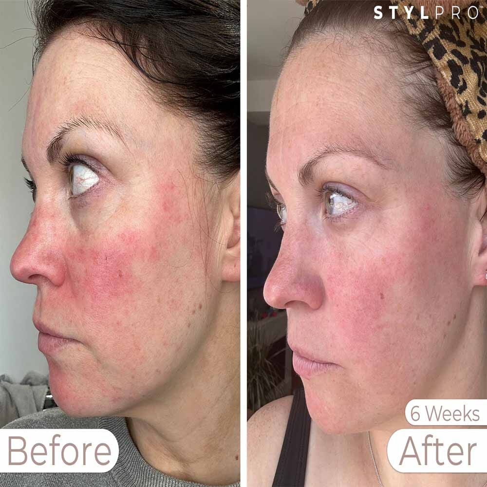 StylPro Wavelength LED Face Mask | Face Masks & Treatments | Salon Services